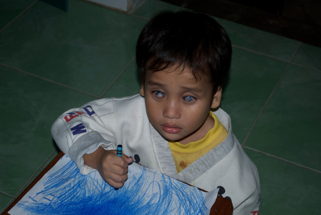 OGCDC – Hú’ê – Nadala – Infants discapacitats - Chào ông Viêt Nam